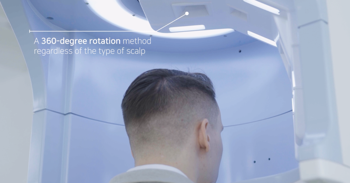 Innovative Hair Loss Diagnostic System, Hair Scale, AFS 3D