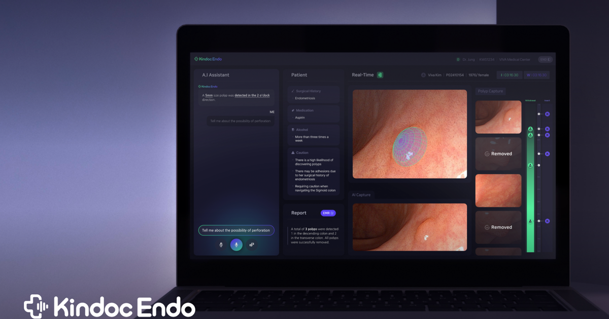 KINDOC Endo - The generative AI solution for endoscopy